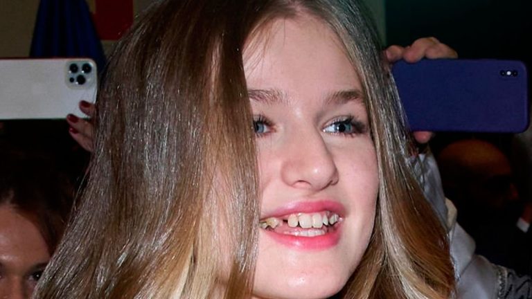 How Orthodontics Transformed Princess Leonor's teeth