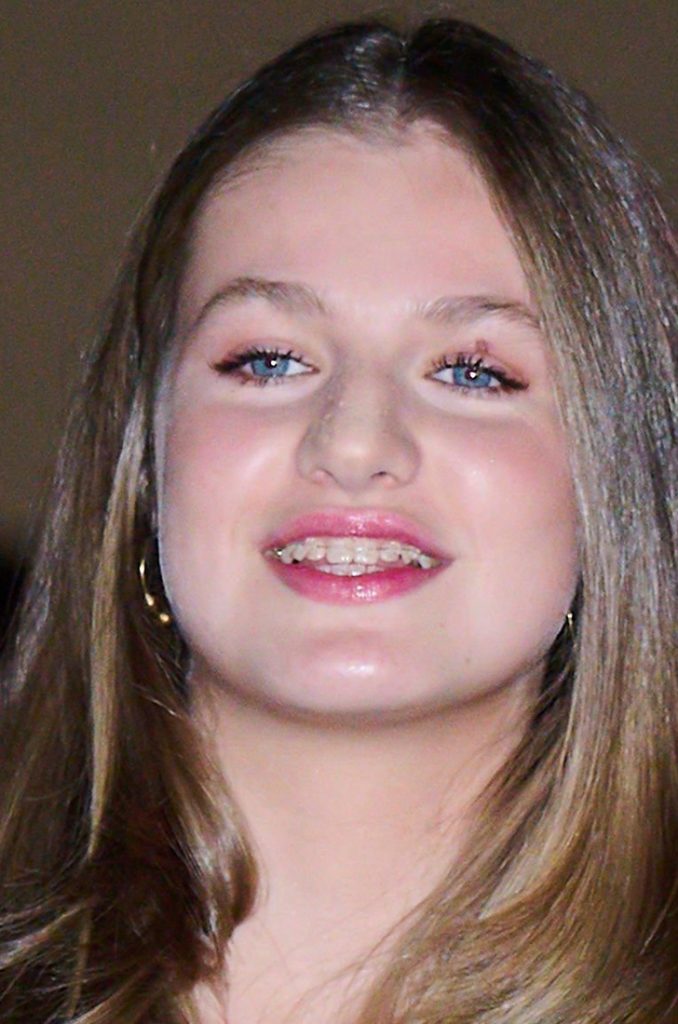 PHOTOS Princess Leonor's eye injury: What happened to her?