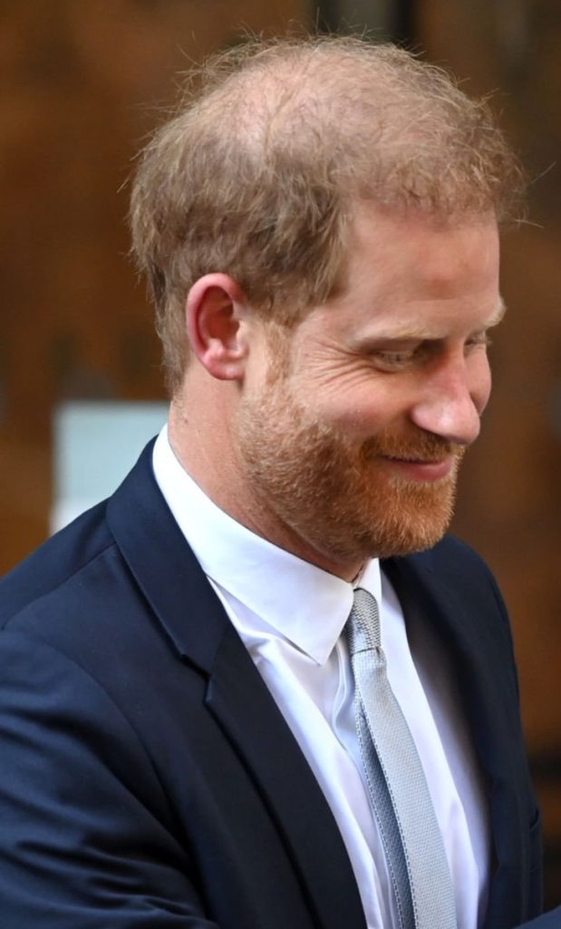 PHOTOS: Did Prince Harry have a hair transplant?