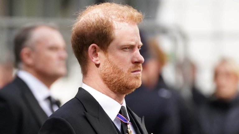 The edited photo of Prince Harry's baldness that caused controversy