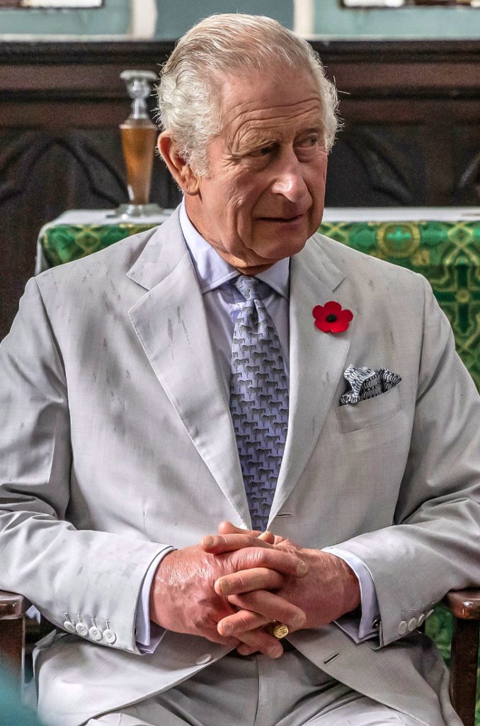 King Charles' sausage fingers: possible medical causes