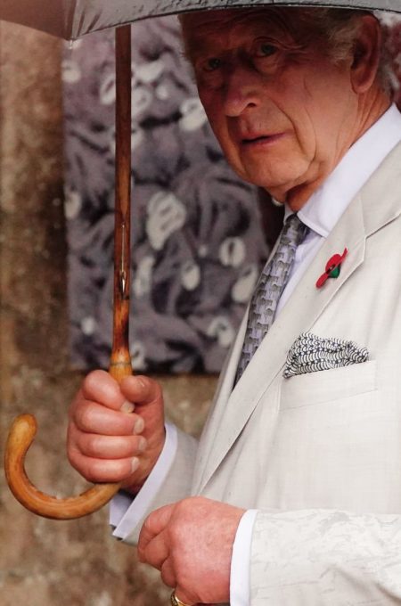 King Charles' sausage fingers: possible medical causes