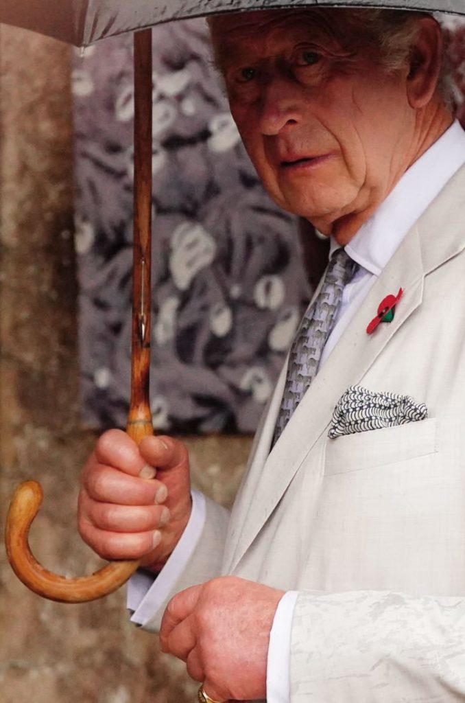 King Charles' sausage fingers: possible medical causes