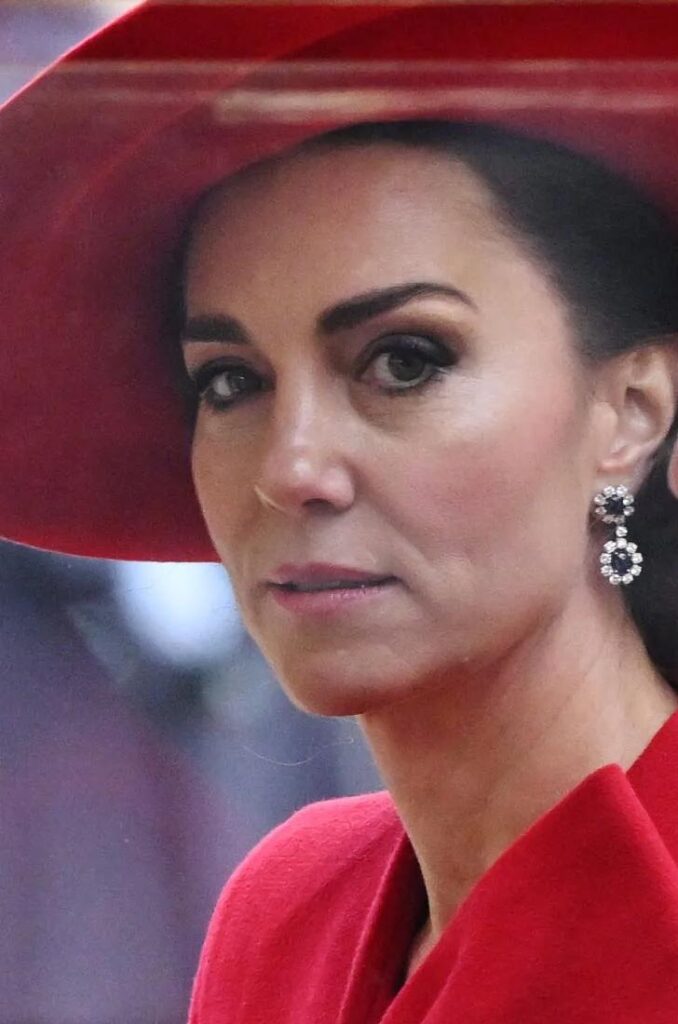 Princess Kate leaves hospital: What is her diagnosis and why is it ...