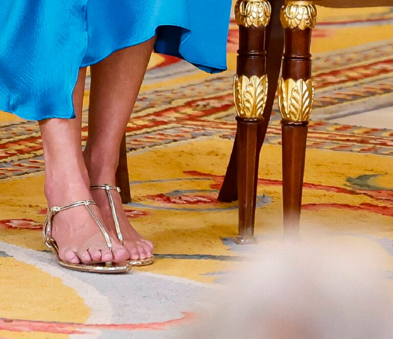 Queen Letizia's Foot Treatment Unveiled: What Is syndactyly?