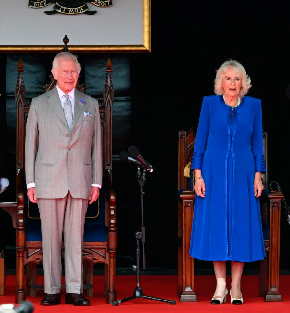 Queen Camilla's Foot Injury on Visit to Guernsey