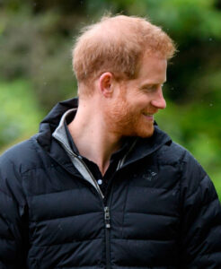Prince Harry Balding: Expert Urges Him to Embrace It